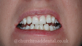Dental Smile Gallery | Church Road Dental