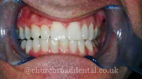 Dental Smile Gallery | Church Road Dental