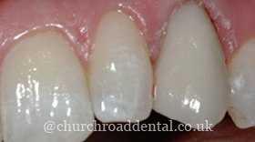 Dental Smile Gallery | Church Road Dental