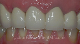 Dental Smile Gallery | Church Road Dental
