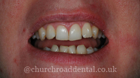 Dental Smile Gallery | Church Road Dental