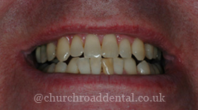 Dental Smile Gallery | Church Road Dental